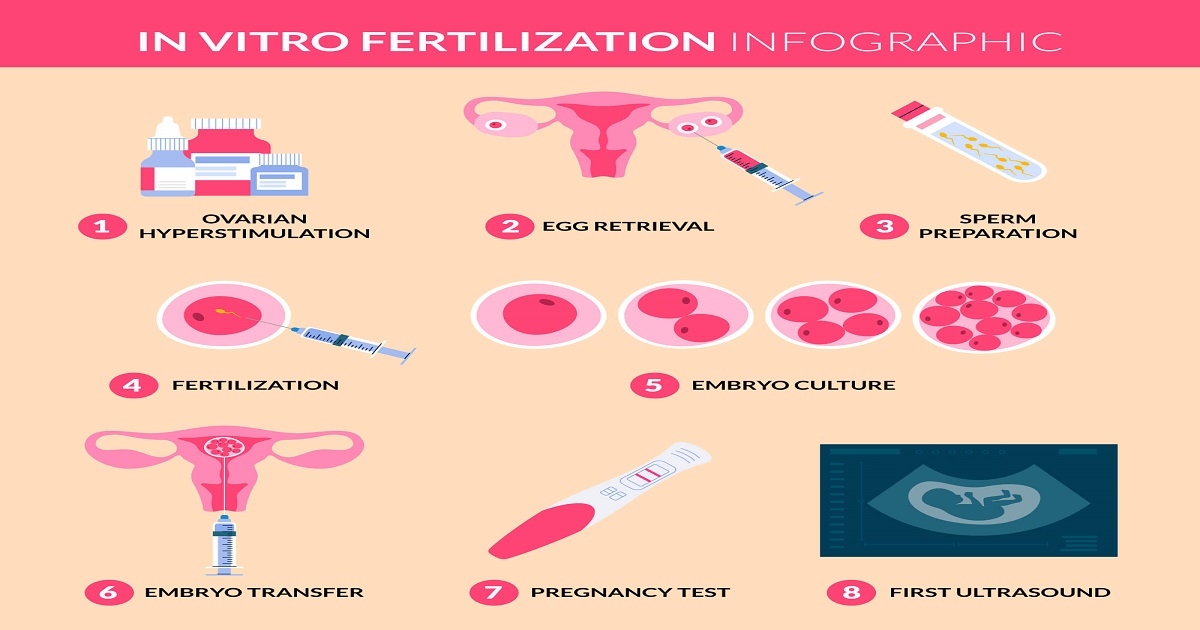 IVF Kya Hai | IVF Process Step by Step in Hindi: Dr. Mona IVF Kya Hai | IVF Process Step by Step in Hindi: Dr. Mona